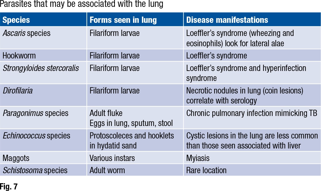 Parasites in tissue: how to identify the structures