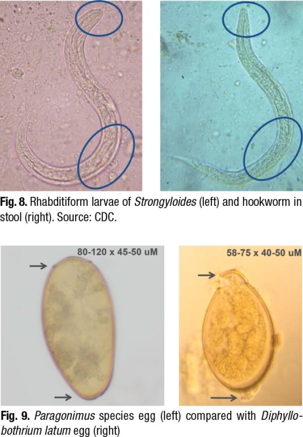 Parasites in tissue: how to identify the structures